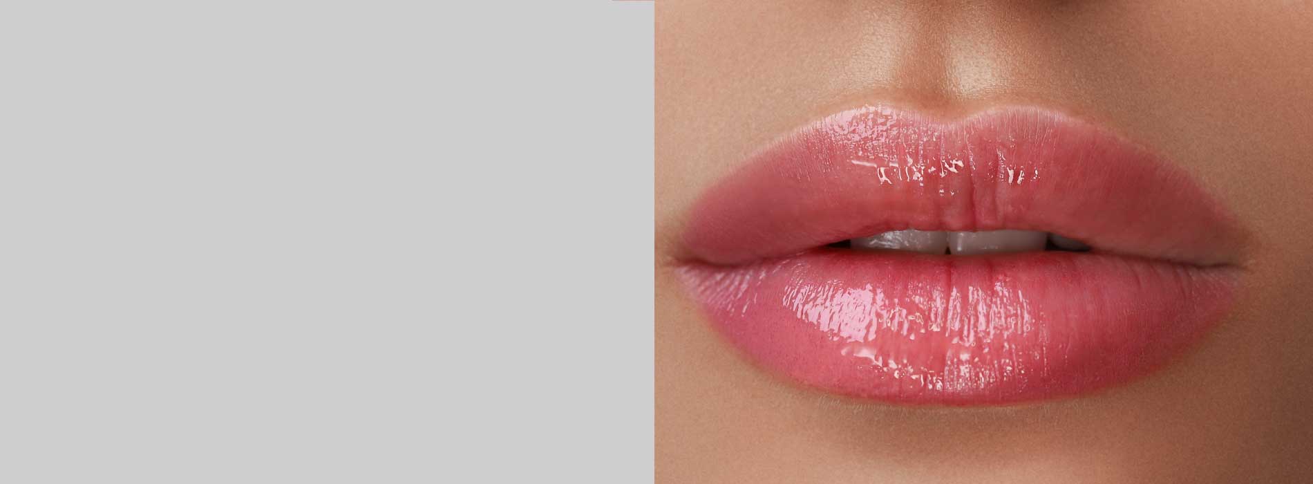 LIP AUGMENTATION - BEAUX MedSpa